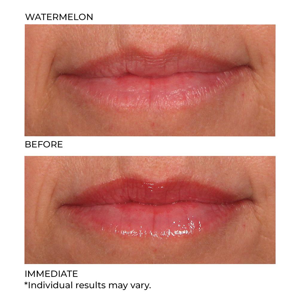Hydro-Screen For Lips, Lip Moisturizing Serum - NassifMD® Skincare